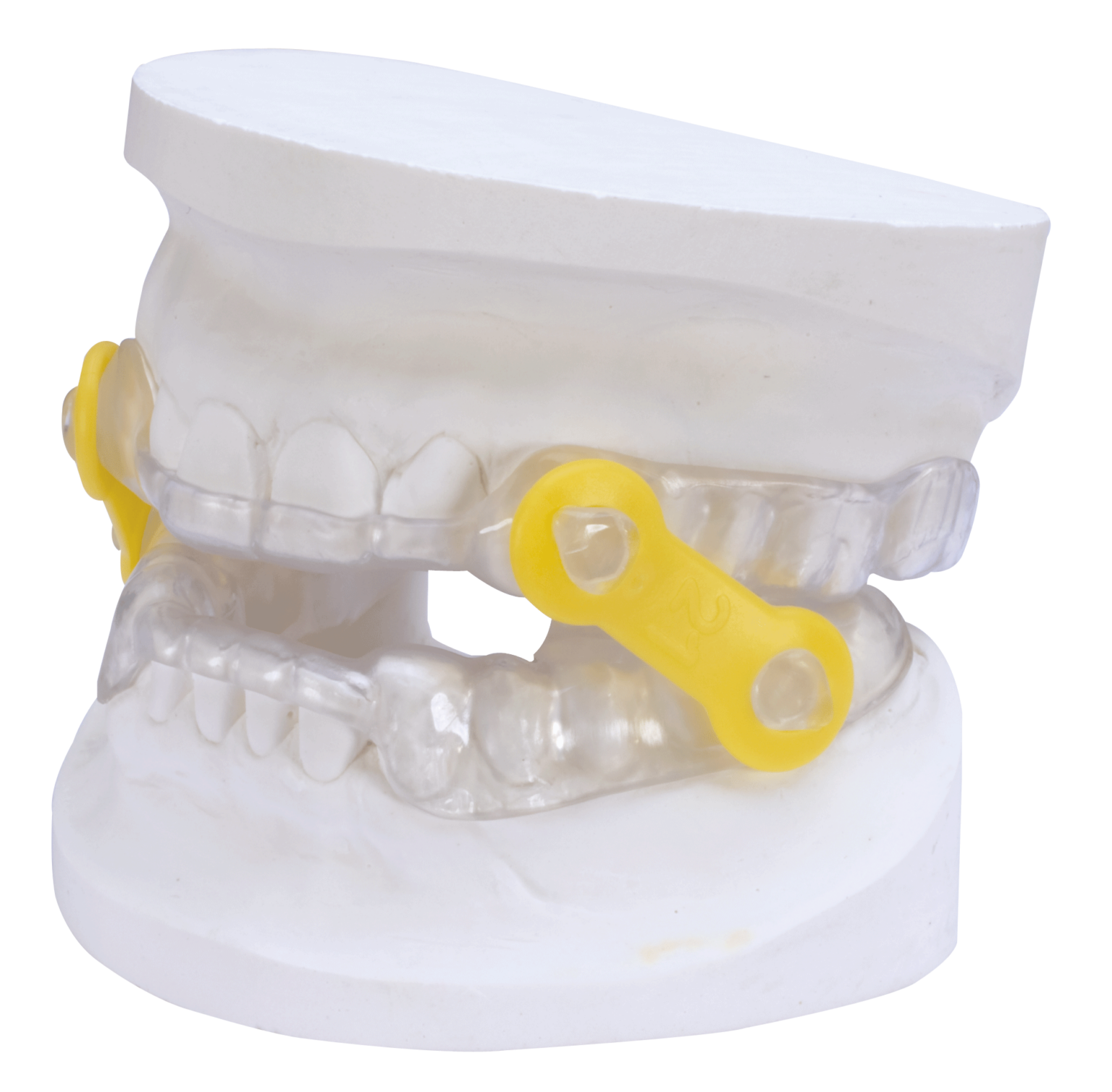 Breathe Easy: Exploring Anti-Snoring Appliances Available at Southern ...