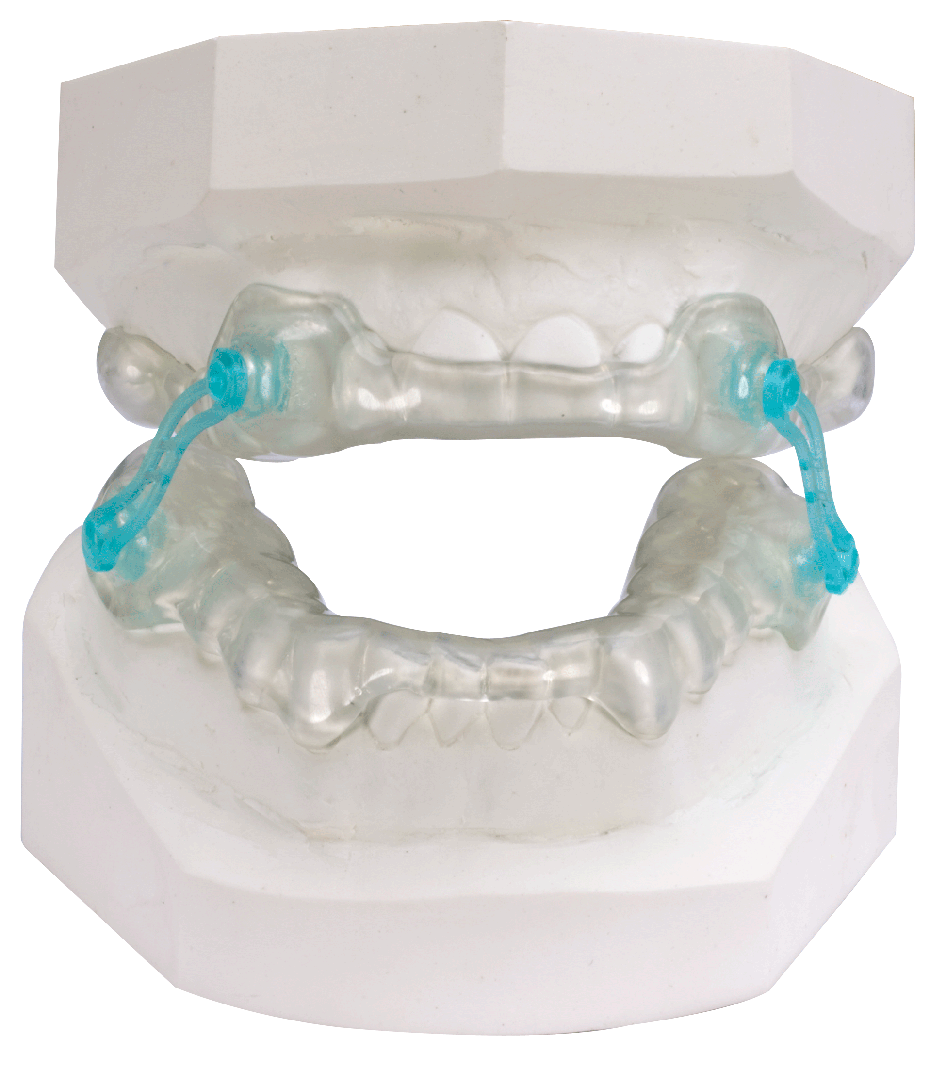 Breathe Easy: Exploring Anti-Snoring Appliances Available at Southern ...